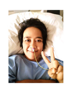 Naso-Duodenal (ND) Or Naso-Jejunal (NJ) Tube Procedure - TubeFed